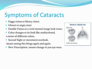 Eye problem "Cataracts" | PPT