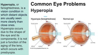 Eye problems.pptx