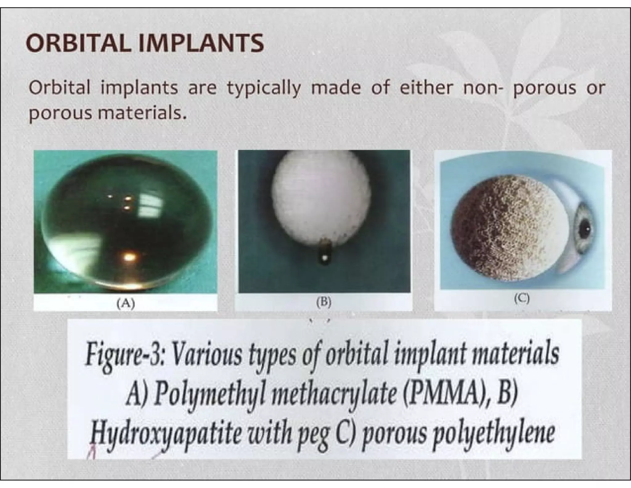 eye prosthesis and rehabilitation.pdf