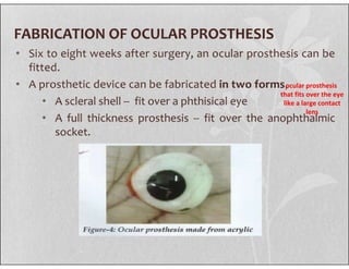 eye prosthesis and rehabilitation.pdf