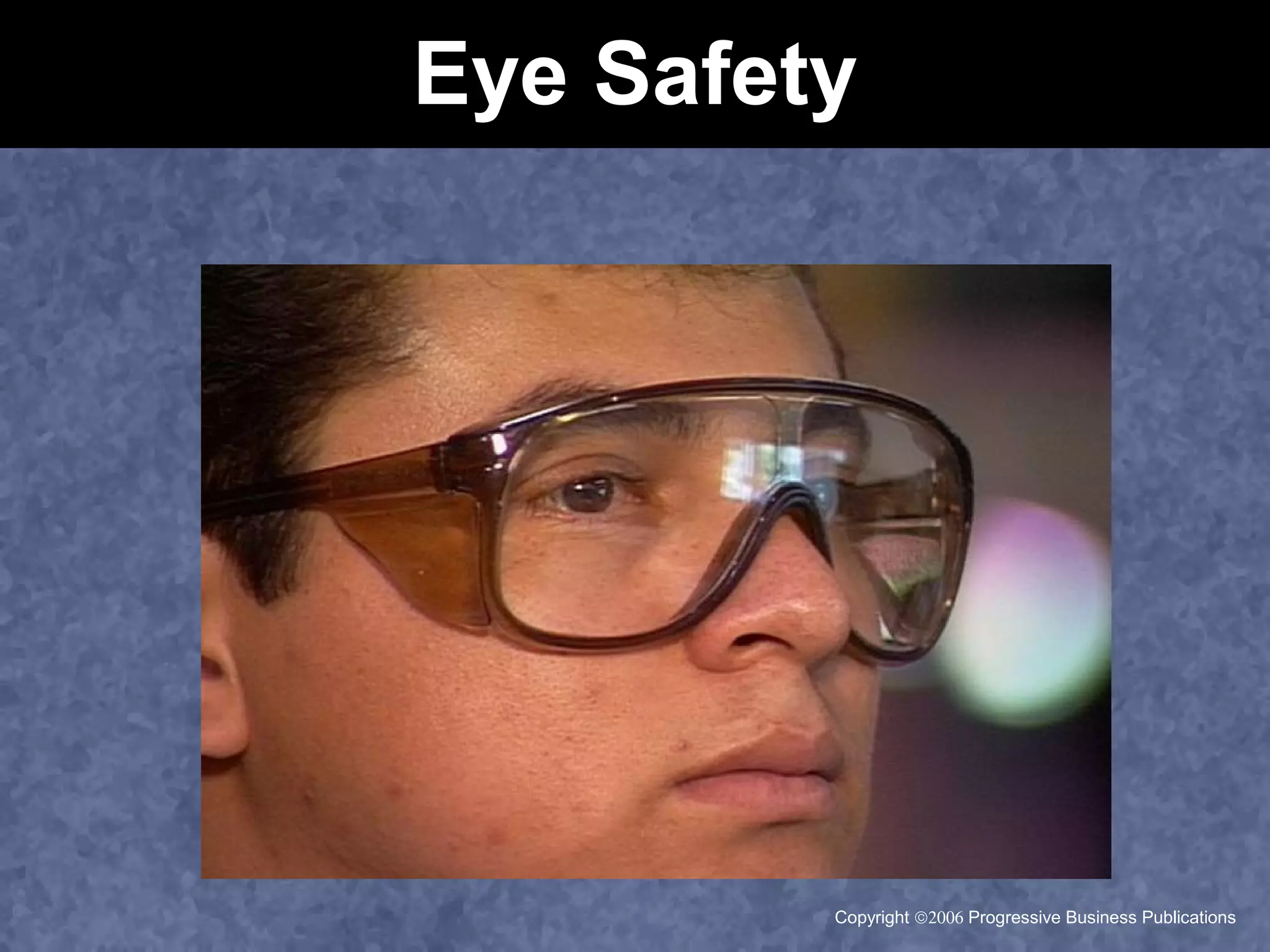 Eye protection by GCKATS | PPT