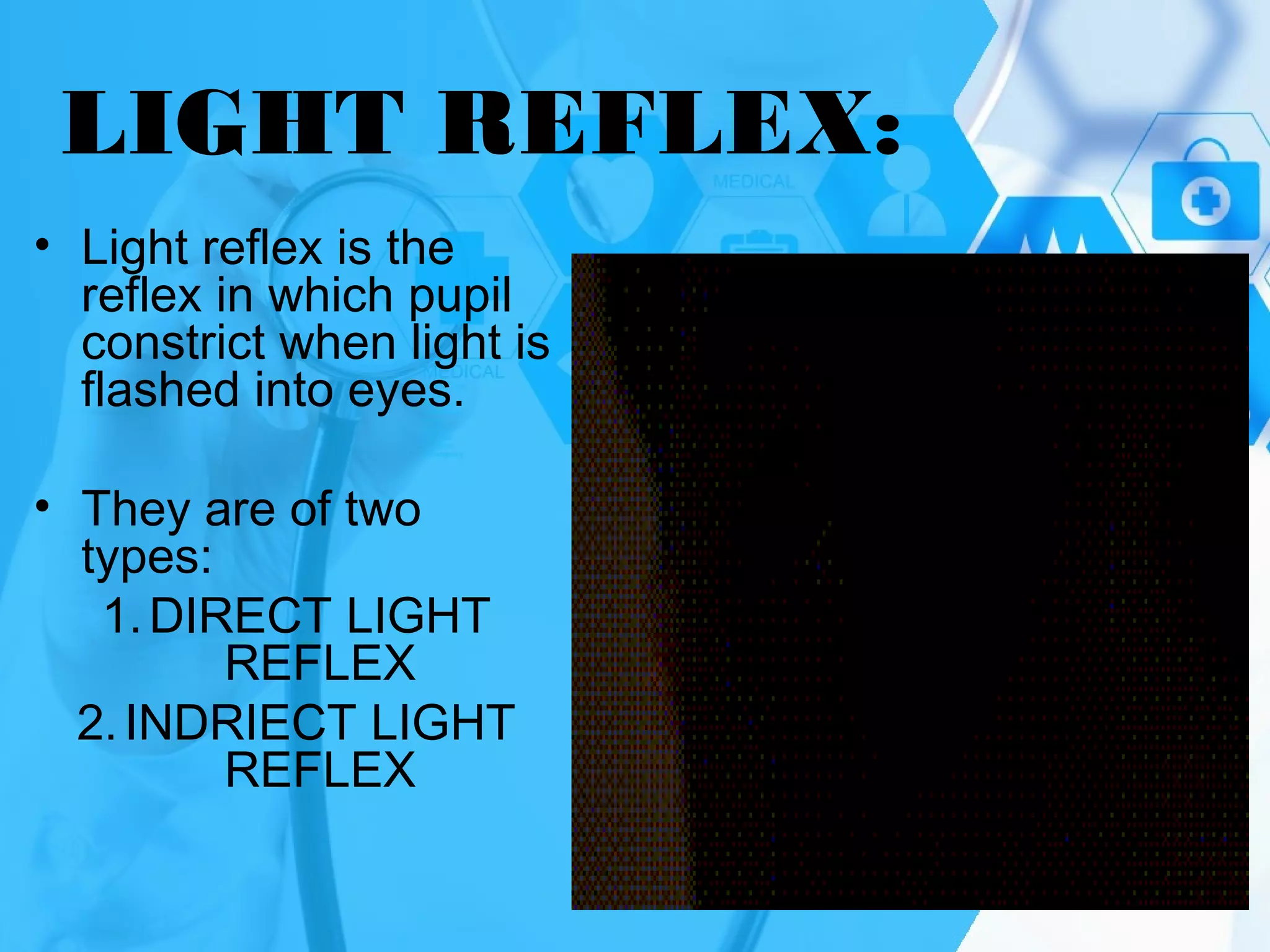 accommodation,reflexes,defects of vision | PPT