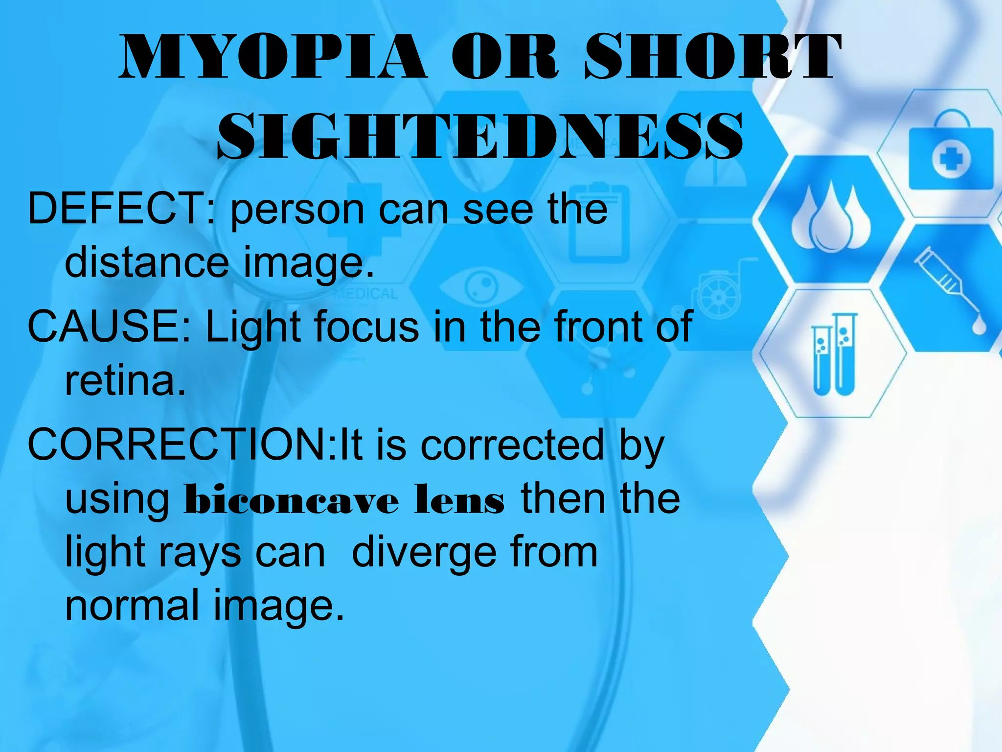 accommodation,reflexes,defects of vision | PPT