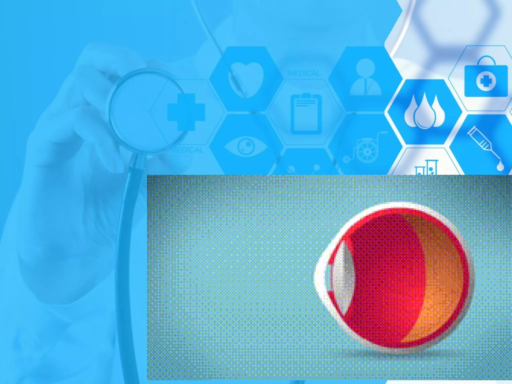 accommodation,reflexes,defects of vision | PPT