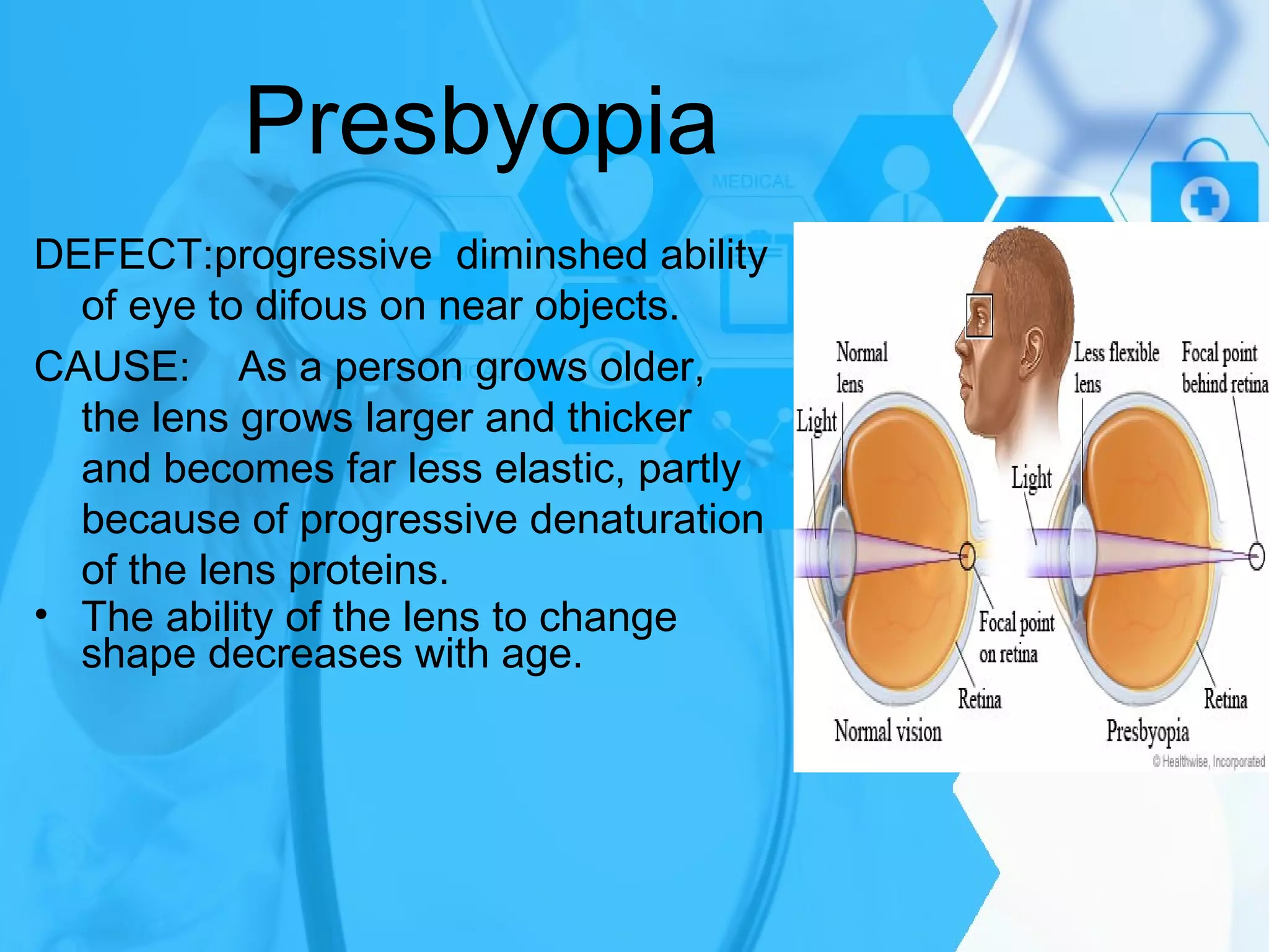 accommodation,reflexes,defects of vision | PPT