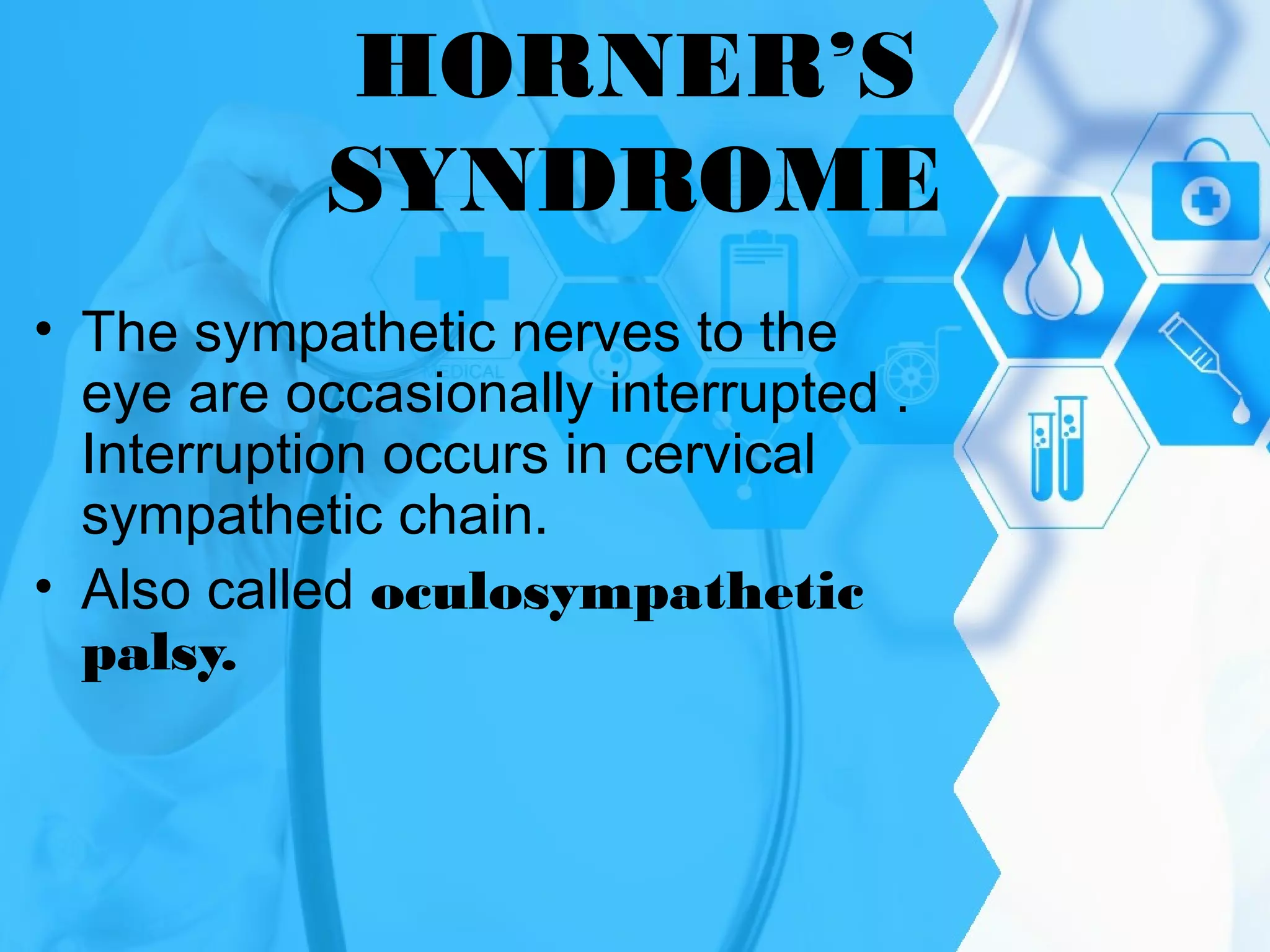 accommodation,reflexes,defects of vision | PPT