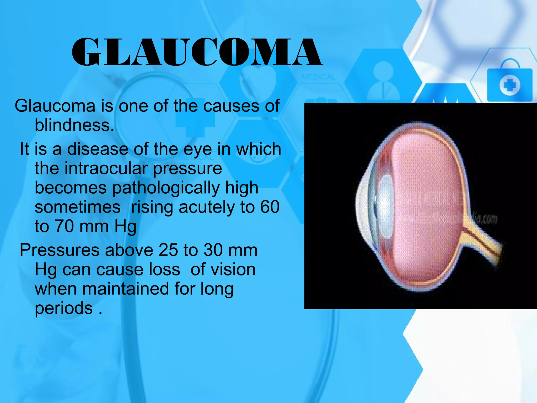 accommodation,reflexes,defects of vision | PPT