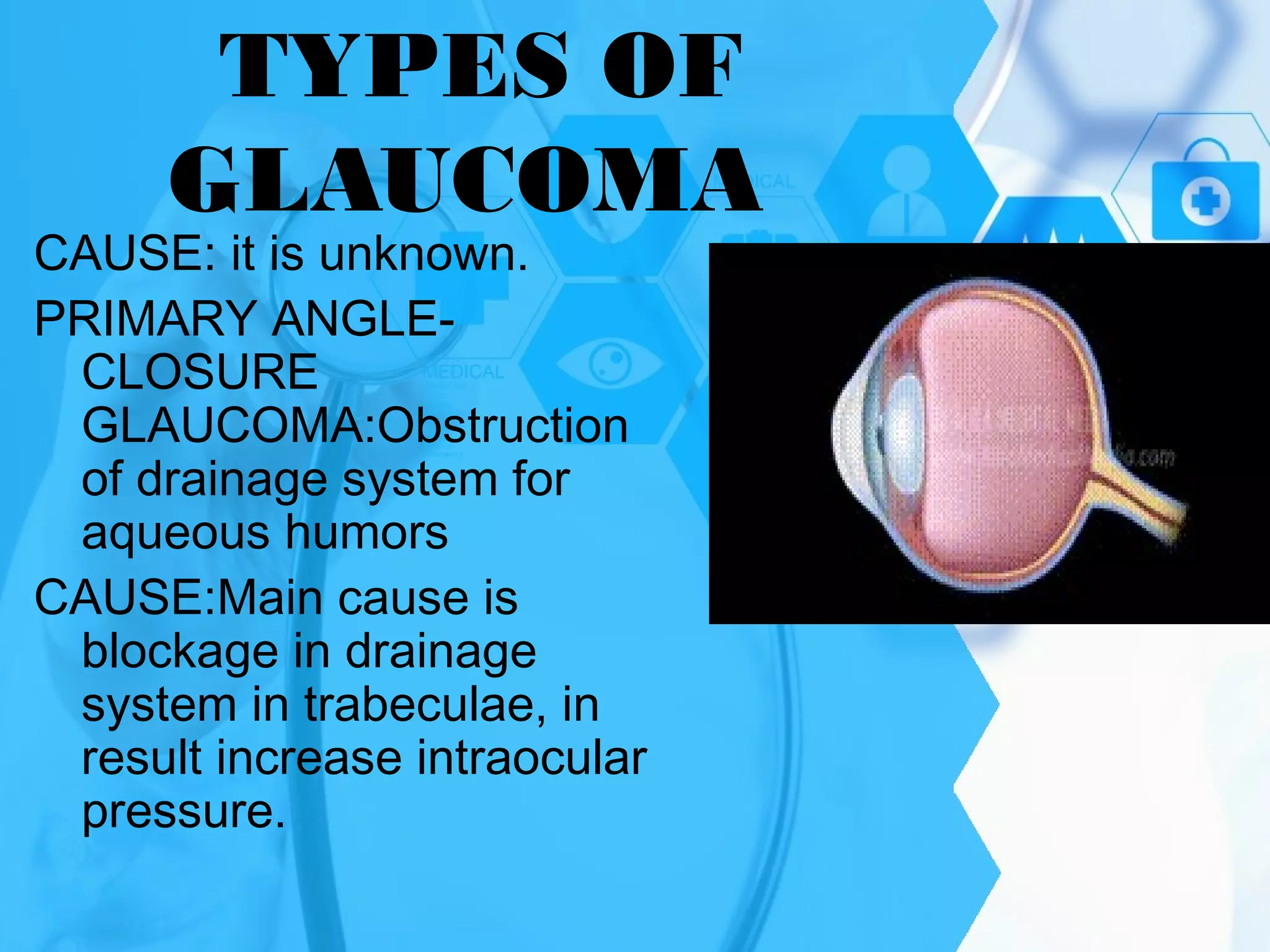 accommodation,reflexes,defects of vision | PPT