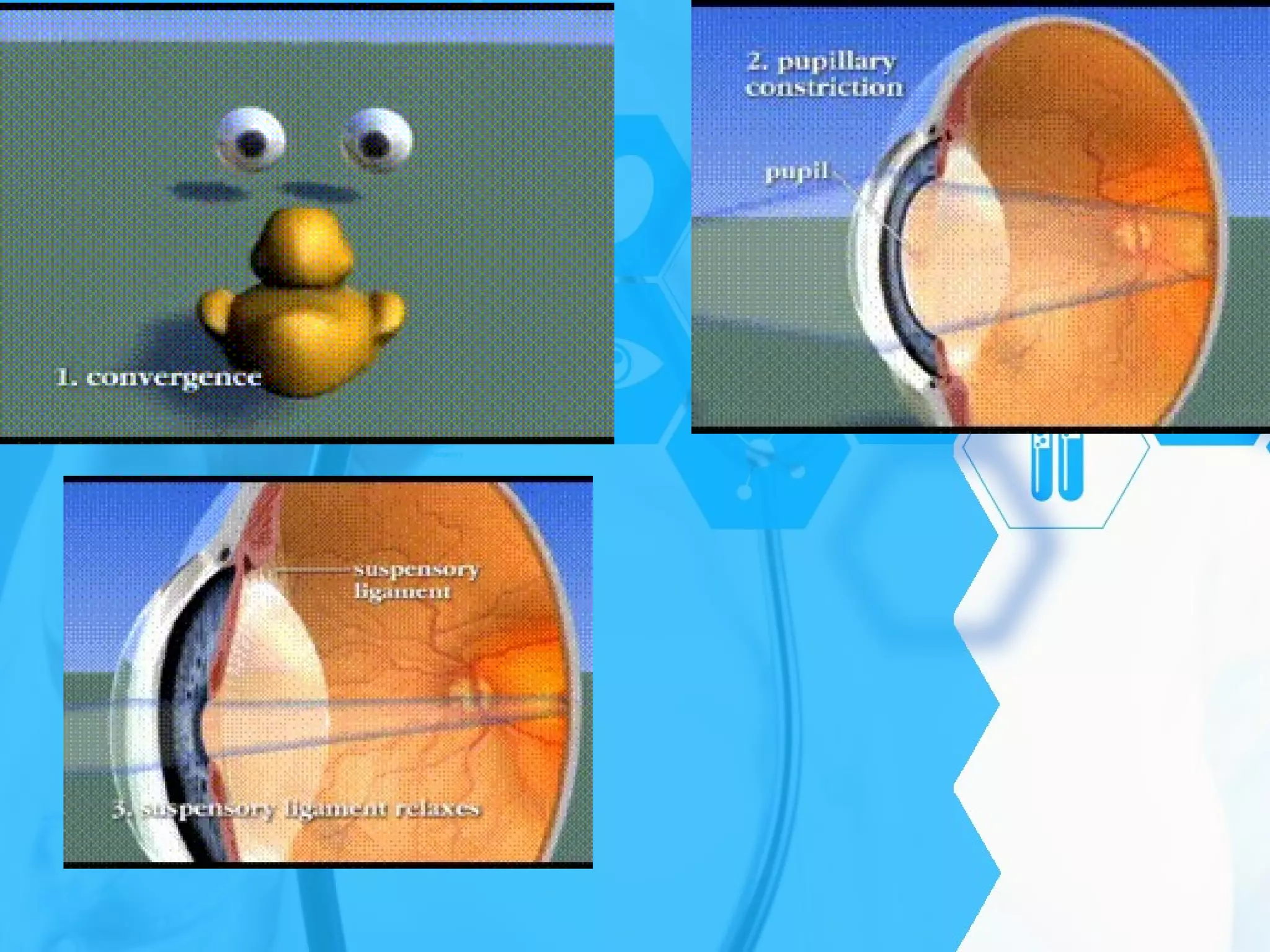 accommodation,reflexes,defects of vision | PPT