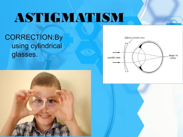 accommodation,reflexes,defects of vision | PPT