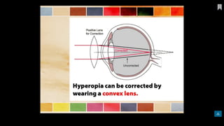 Eyes-and-Defects-Optical-Instruments.pptx