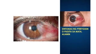 Eyes-and-Defects-Optical-Instruments.pptx