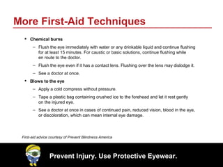 Eye safety at work | PPT