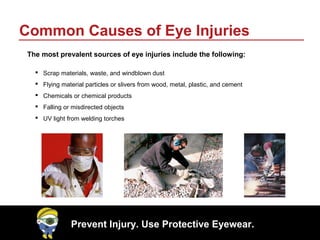 Eye safety at work | PPT
