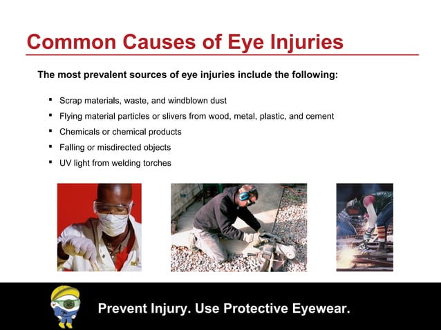 Eye safety at work | PPT