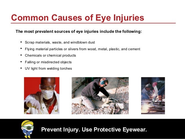 Eye safety at work