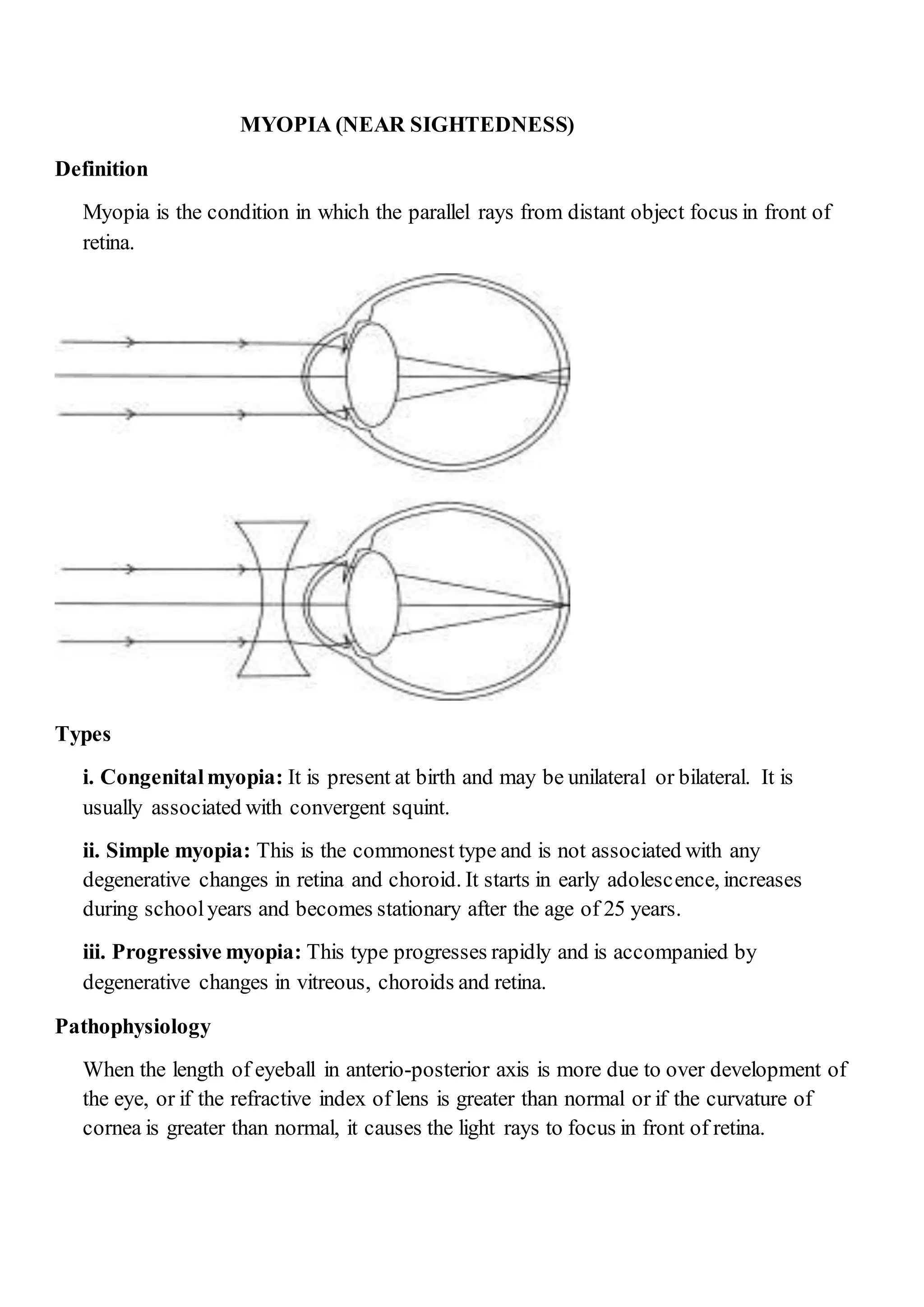 EYE DISORDERS IN PAEDIATRICS | DOCX