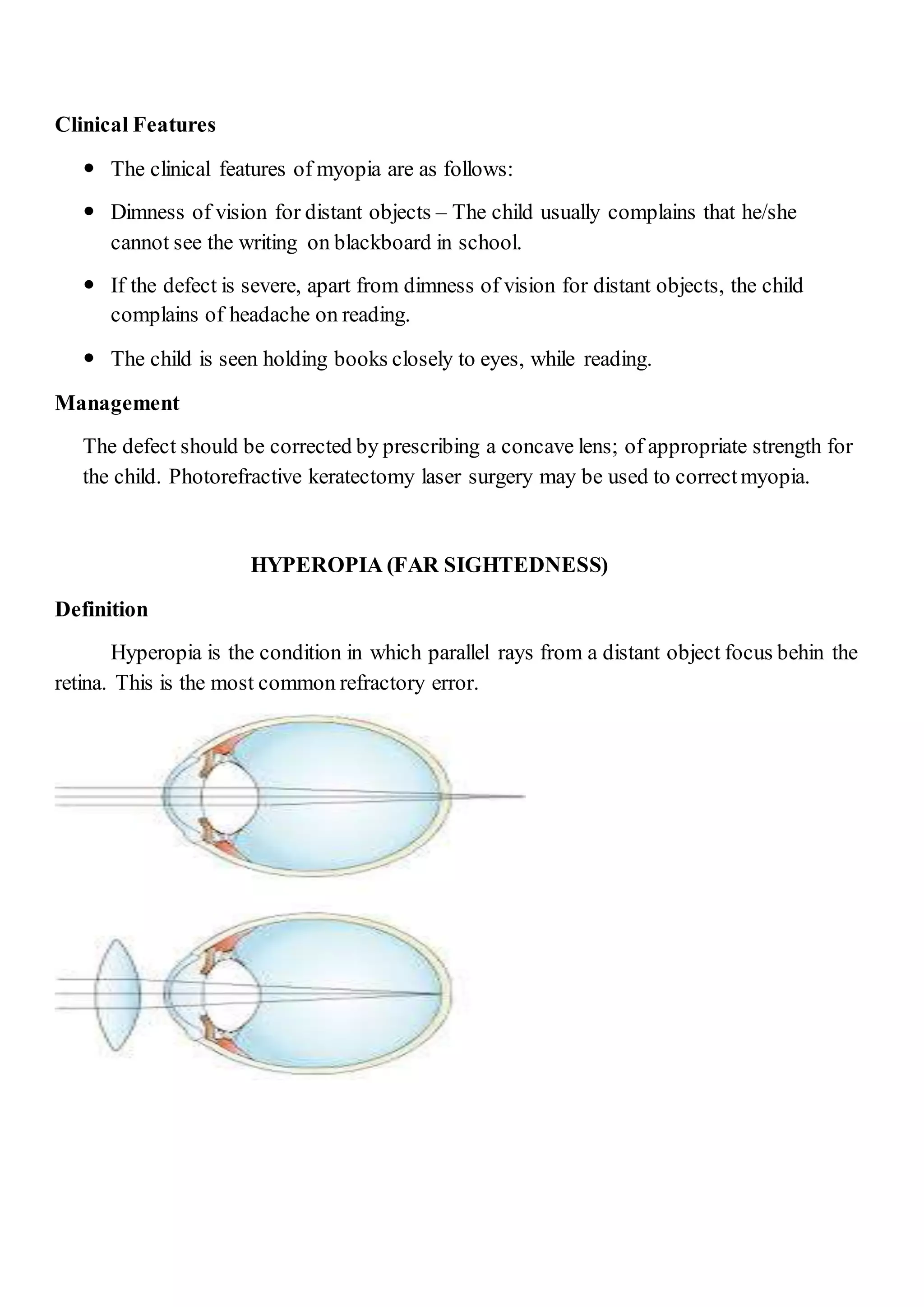 EYE DISORDERS IN PAEDIATRICS | DOCX