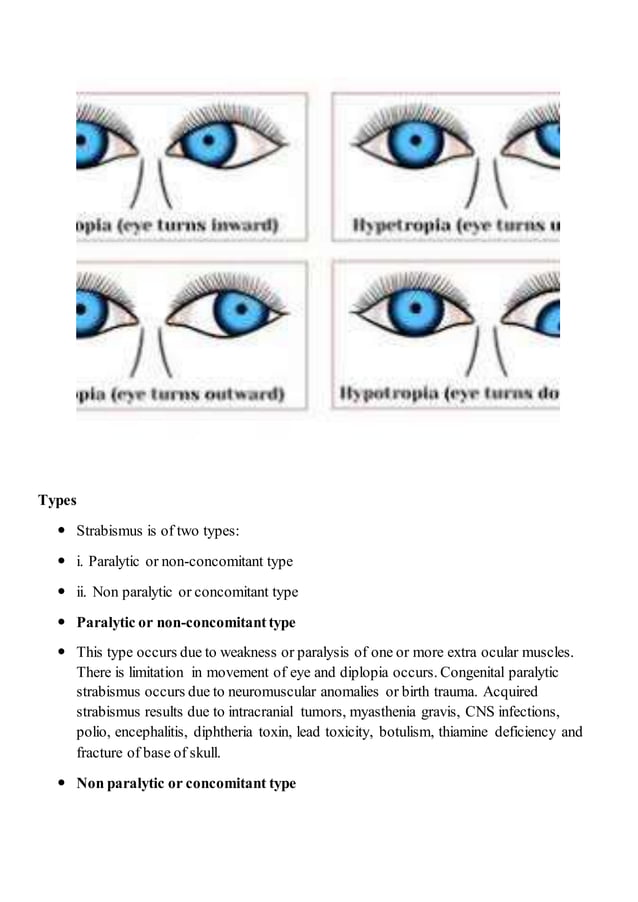 EYE DISORDERS IN PAEDIATRICS | DOCX