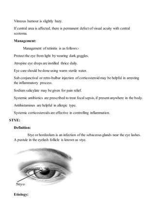 EYE DISORDERS IN PAEDIATRICS | DOCX
