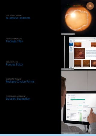 Eyesi Direct Brochure | PDF