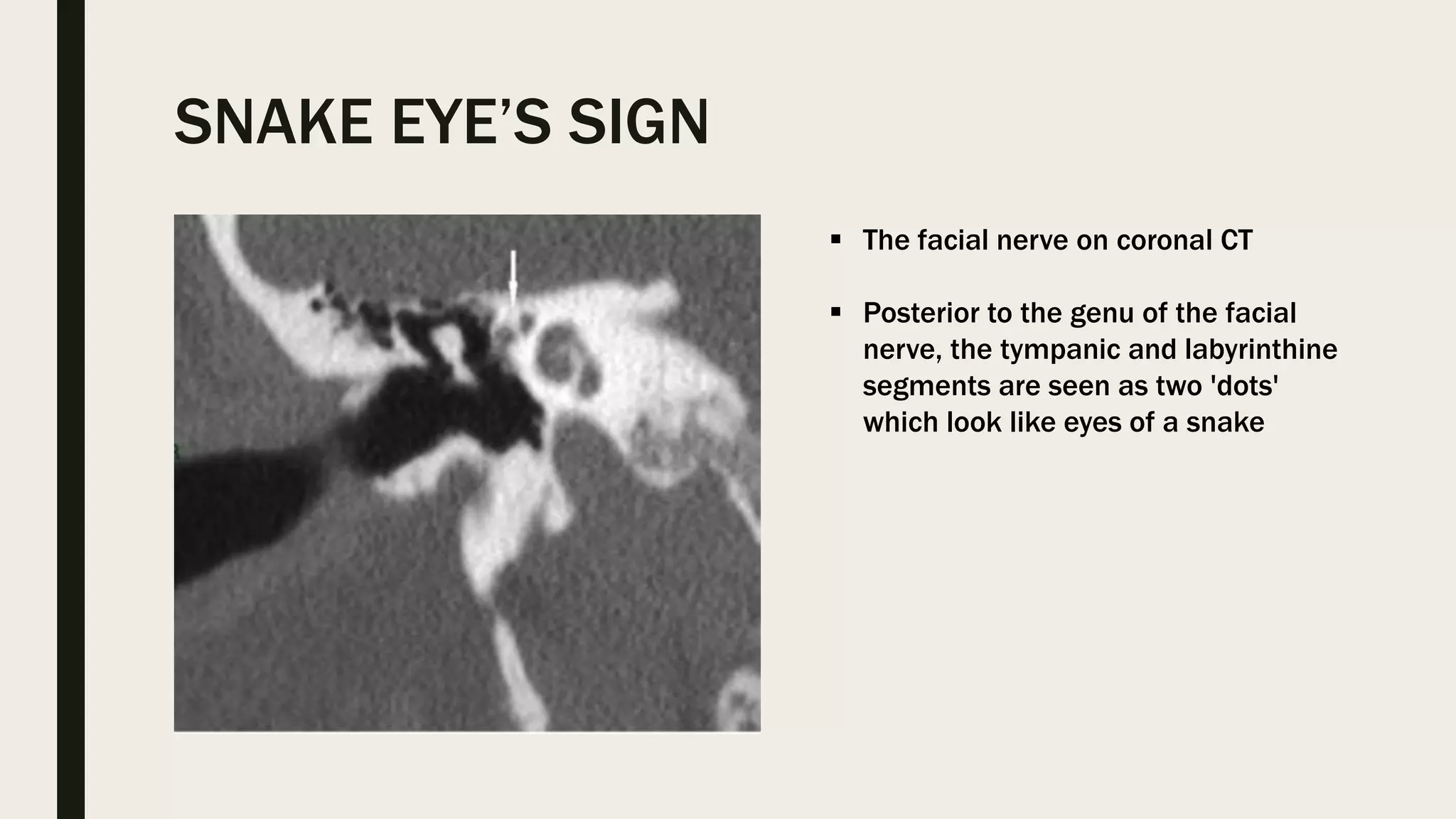 Eye signs in radiology | PPTX