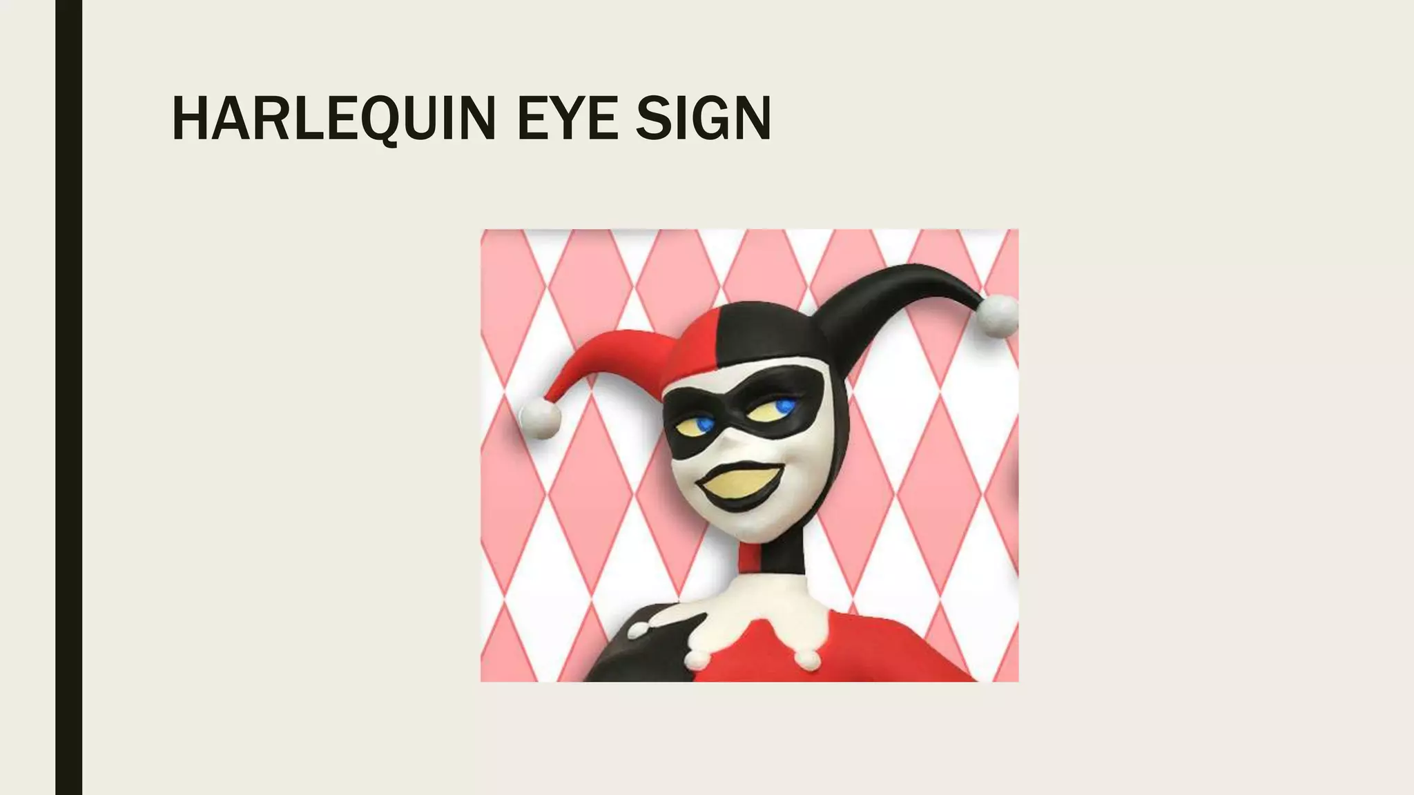 Eye signs in radiology | PPTX