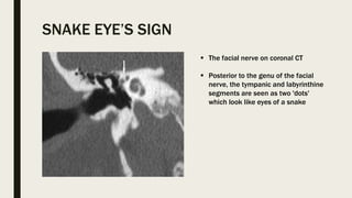 Eye signs in radiology | PPTX
