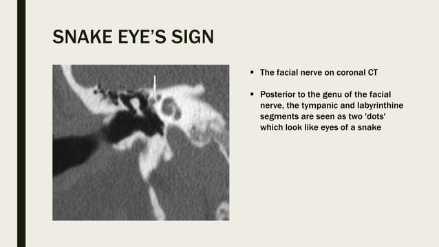 Eye signs in radiology | PPTX | Eye and Vision Conditions | Diseases ...