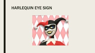 Eye signs in radiology | PPTX