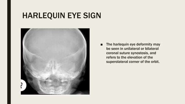 Eye signs in radiology | PPTX | Eye and Vision Conditions | Diseases ...