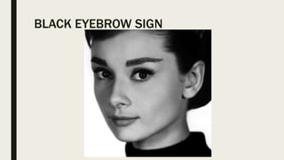 Eye signs in radiology | PPTX