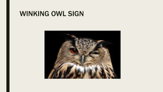 Eye signs in radiology | PPTX | Eye and Vision Conditions | Diseases ...