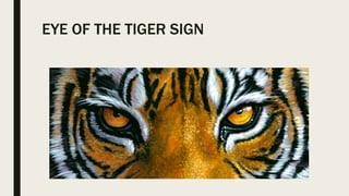 Eye signs in radiology | PPTX