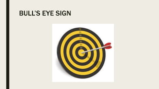Eye signs in radiology | PPTX
