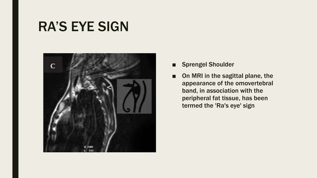 Eye signs in radiology | PPTX | Eye and Vision Conditions | Diseases ...