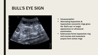 Eye signs in radiology | PPT
