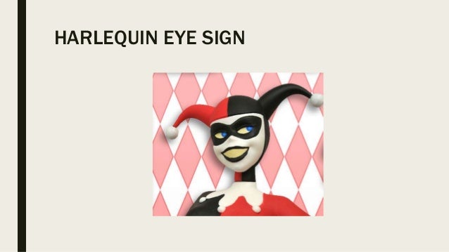 Eye signs in radiology