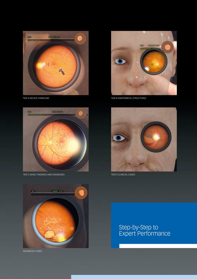 Eyesi Indirect Brochure | PDF