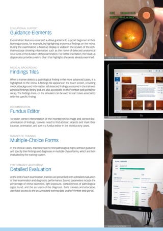 Eyesi Indirect Brochure | PDF