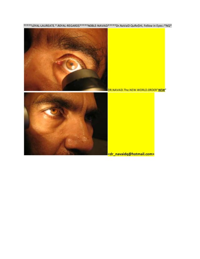 Eyes=PEN-LiGHT EXAM.By.Dr.NaVaiD.NQ. | DOCX | Eye and Vision Conditions ...