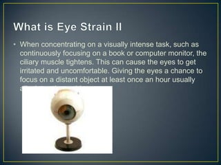 Eye strain | PPTX