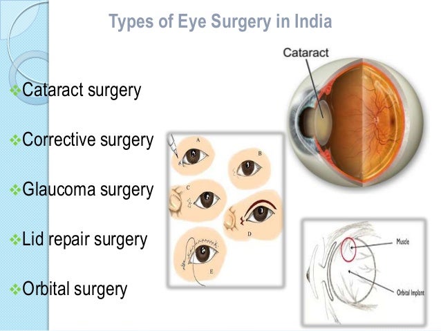 Eye Surgery in India Brings Back The Shine Of Your Eyes
