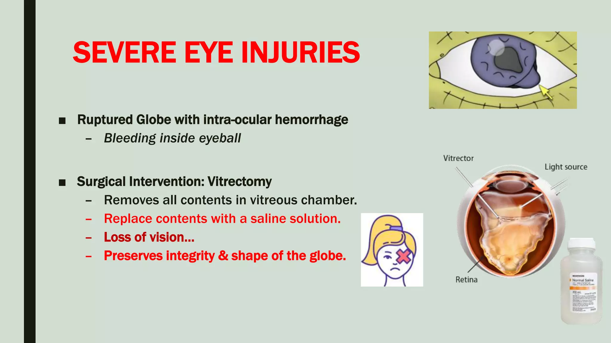 Eye trauma | PPT