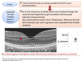 ez affection in glaucoma..between fact and fiction (1).pptx