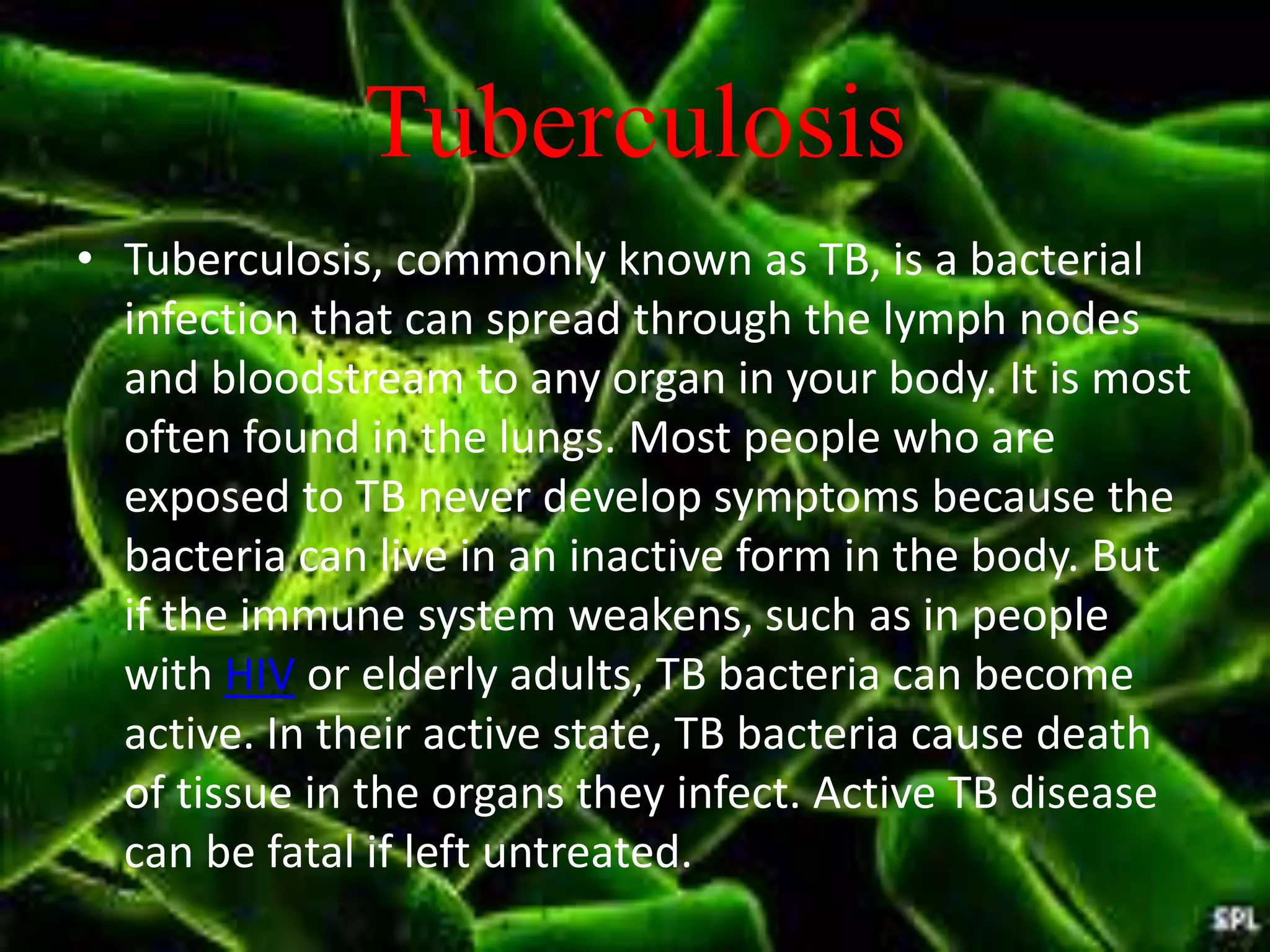 tuberculosis | PPTX