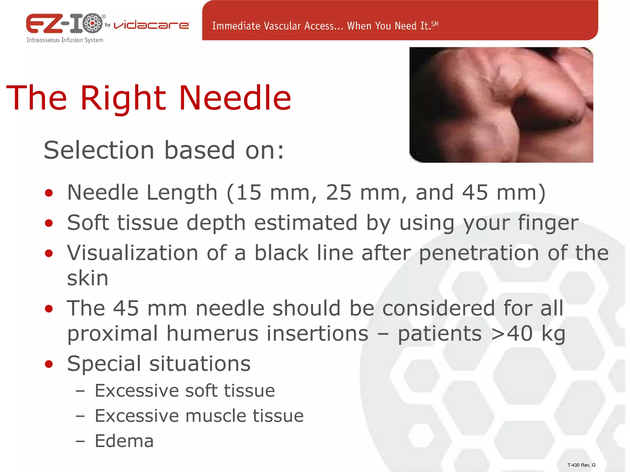 EZ I/O Presentation at FCA | PPTX