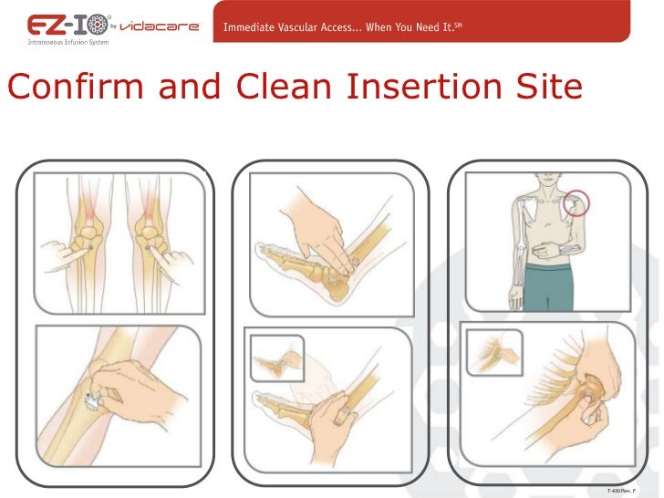 EZ I/O Presentation at FCA