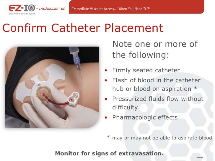EZ I/O Presentation at FCA