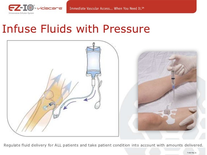 EZ I/O Presentation at FCA